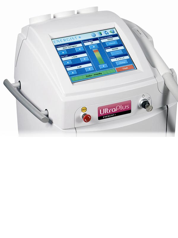 Simmer Engineering Limited